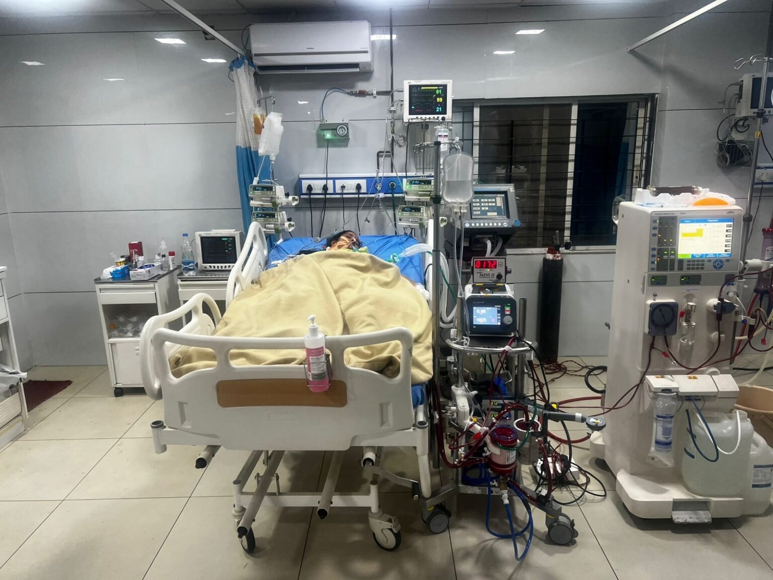 Gujarat’s 1st Successful Maternal ECMO Case - Naari Women's Hospital